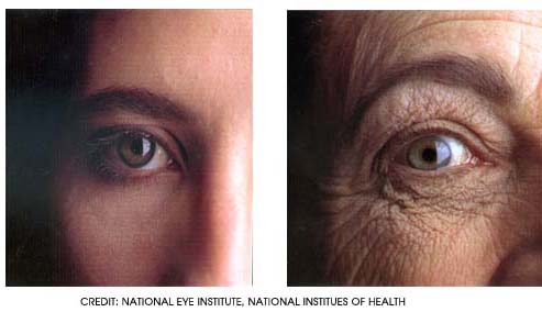 Eye Health - Living the CR Way